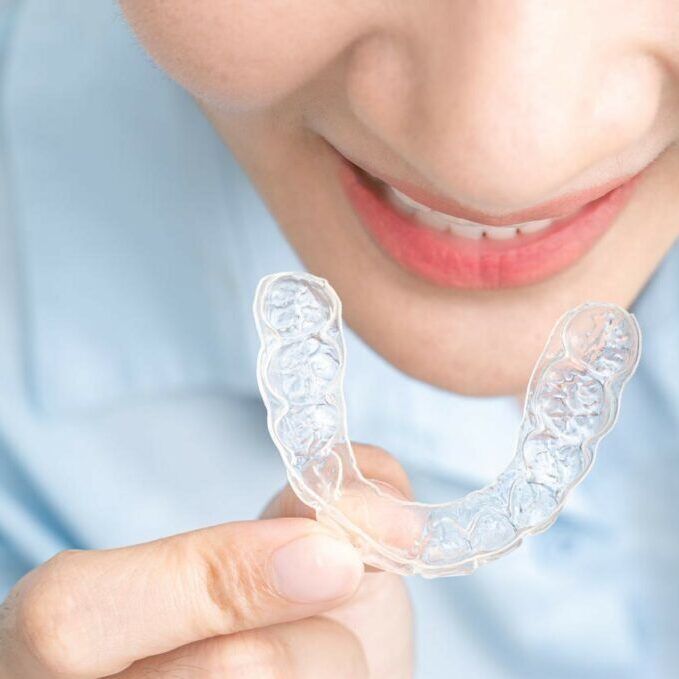 What is an Essix Retainer? | Teeth Retainer in Dubai | NOA Dental ...